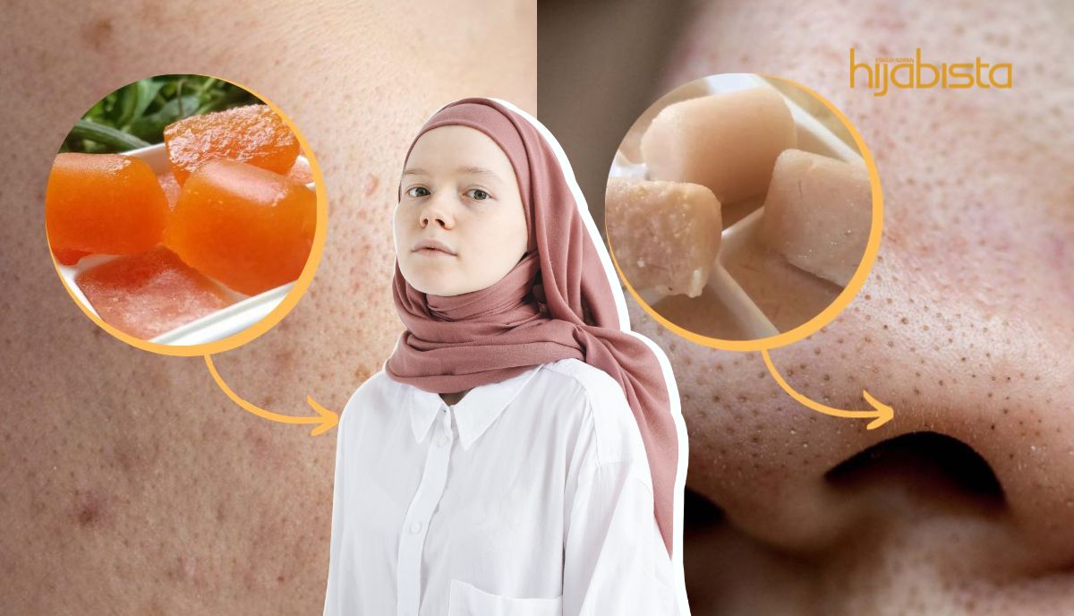 Masalah Pori dan Tompok hitam Boleh 'Settle', Dengan Cara Bajet Kiub ...